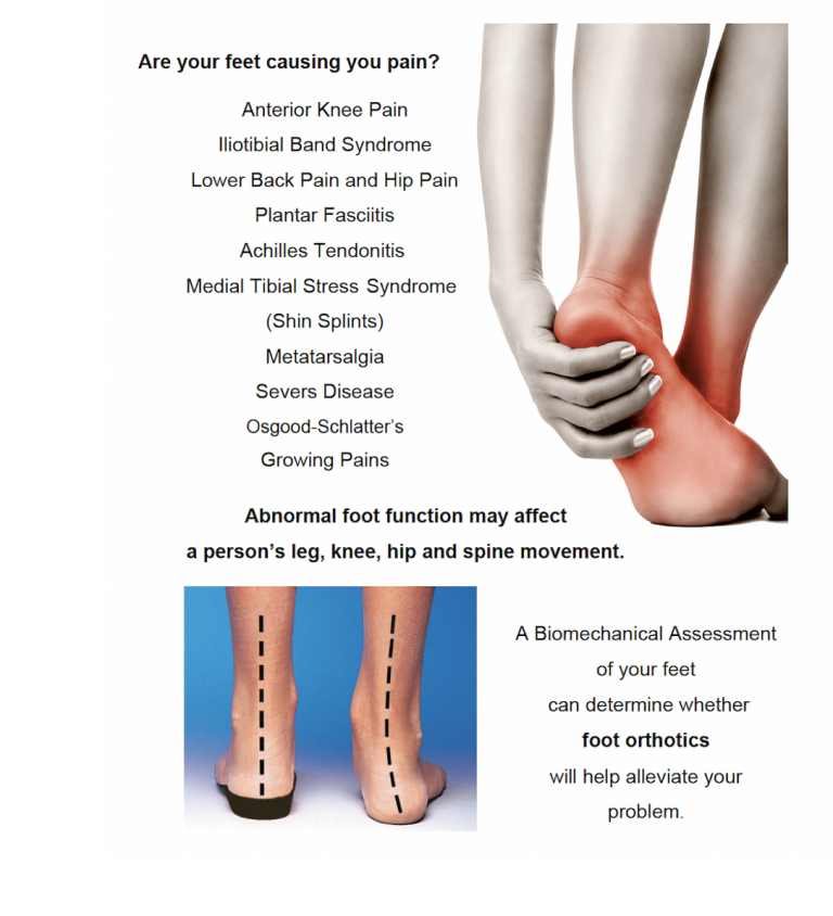 Biomechanical Assessment, Gait Analysis & 3D Imaging at Otley Podiatry ...